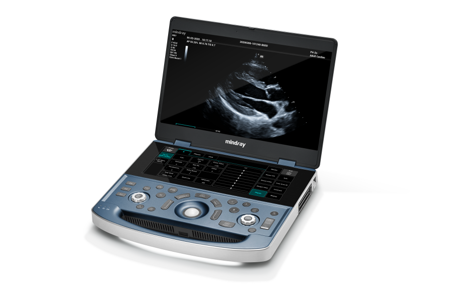 Mindray MX7 echo | Medische Vakhandel